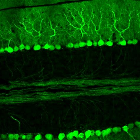 Autism Purkinje Cells And The Cerebellum Are Intertwined Psychology