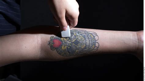 Cómo sacarse tatuajes de la piel
