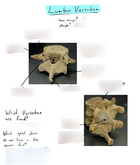 Lumbar Vertabrae Diagram Quizlet
