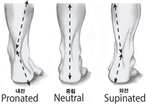 발목과 발의 안정성 가동성 평발 발목 접질림 발목 인대파열 발목통증 발목염좌 골관절 보상작용 방배동헬스 방배동피티 방배동노인재활