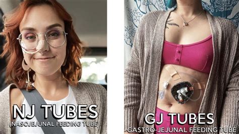Confused About Feeding Tubes Breaking Down The Types Mighty Well Journal