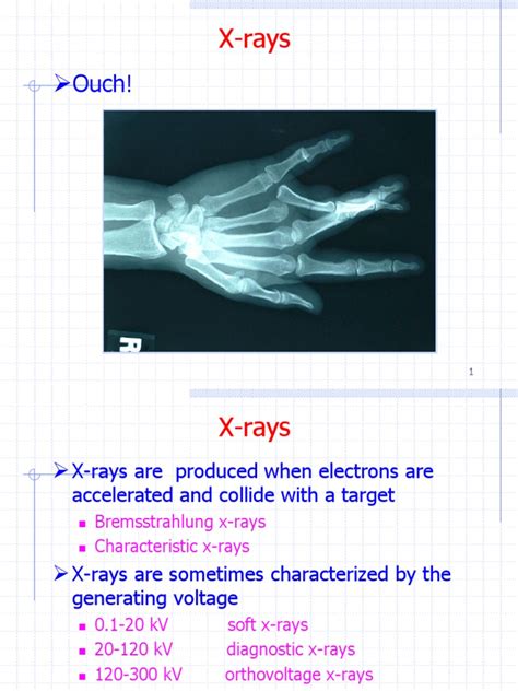 PDF 애리조나 대학 아틀라스 xray 강의자료 phys586 lec05 xray DOKUMEN TIPS