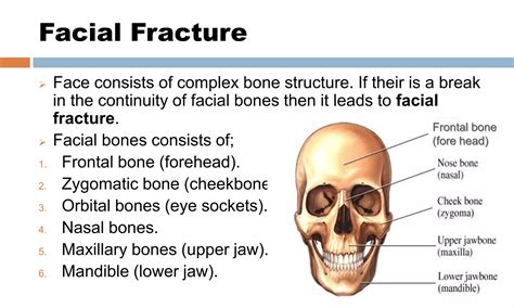 Cranial And Facial Fractures Ppt