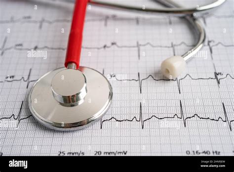 Stéthoscope Sur Ecg Délectrocardiogramme Onde Cardiaque Crise