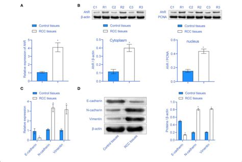 The Expression Of Ahr Was Higher In Rcc A The Mrna Expression Of