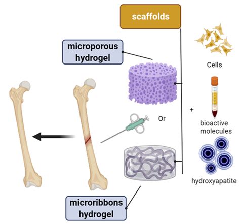 Application Of Nano Inspired Scaffolds Based Biopolymer Hydrogel For Bone And Periodontal Tissue