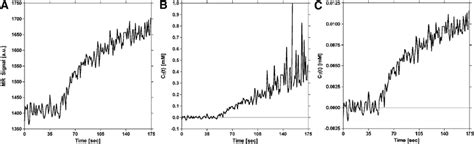 Influence Of S 0 Estimates On Dynamic Contrast Enhanced Dce Mri