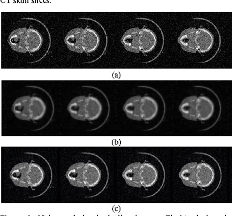 Figure 1 From Denoising 3d Biomedical Images With Fractional Order Integral Calculus Semantic