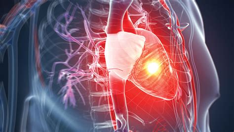 3 D Imaging Techniques Transform Cardiac Catheterization
