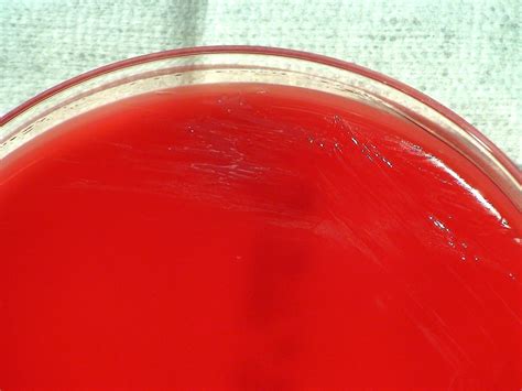 Free Picture Photograph Colonial Morphology Gram Negative