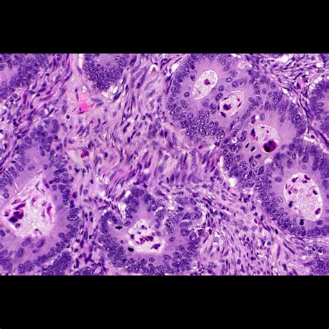 Biomedparse A Foundation Model For Joint Segmentation Detection And