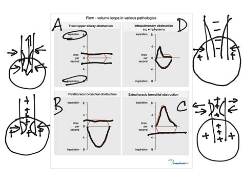 Flow Volume Loops Physiology Pulmonary Function Test ShowMe