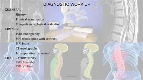Spinal Cord Tumor Pptx