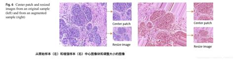 基于初始残差循环神经网络的乳腺癌组织病理学图像的分类病理图像 组织分类 Csdn博客