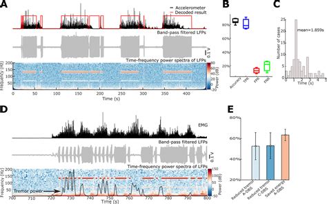 Closed‐loop Deep Brain Stimulation For Essential Tremor Based On Thalamic Local Field Potentials