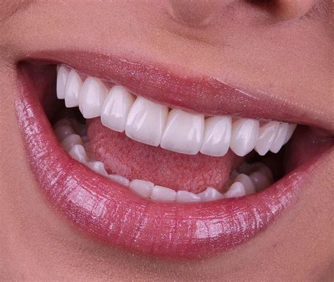 اكواخعجلوناكواخ عجلون اكواخ عجلون الخشبيه الجبل Facebook