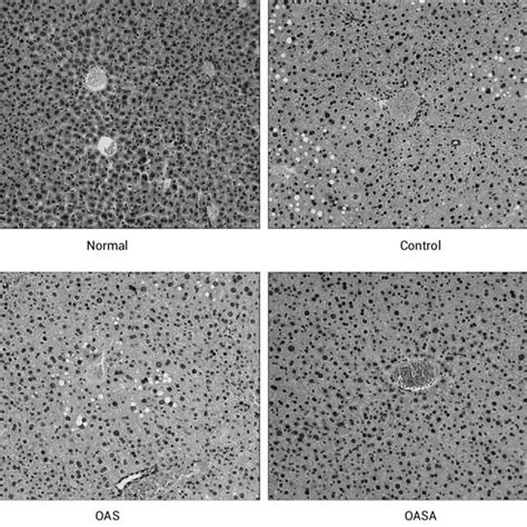 Hande Pathological Observation Of Murine Liver 100× Magnification