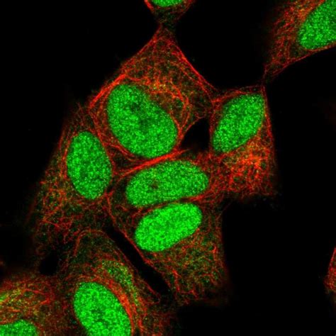 Rabbit Polyclonal Anti Nucks1 Antibody Buy For Research Highly