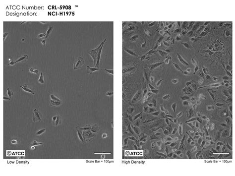 Cell Line Nci H1975 Laboratory Notes