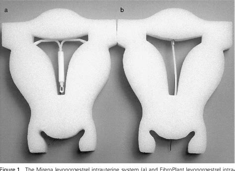 Figure 1 From The European Journal Of Contraception And Reproductive