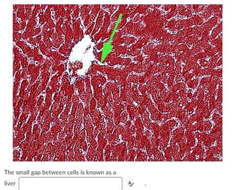 Solved The Small Gap Between Cells Is Known As A Chegg