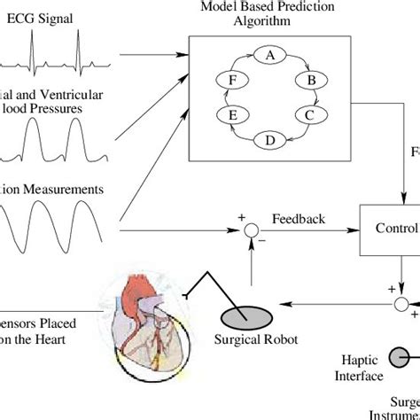 intelligent control algorithms for active relative motion cancellation