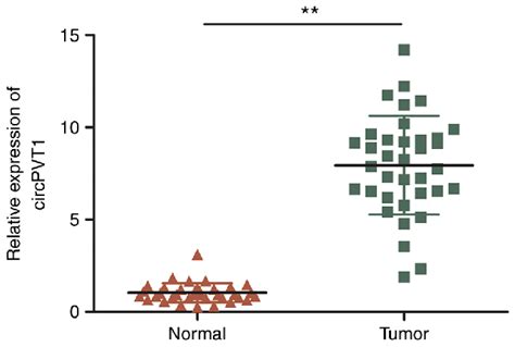Circpvt1 Is Upregulated In Human Thyroid Cancer Tissue Relative
