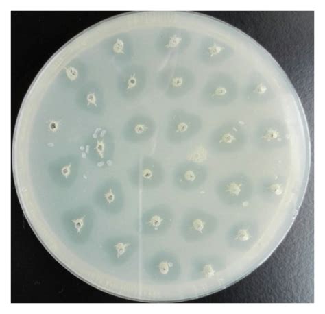Screening Of Strains With Higher Level Of α Amylase Production By Plate