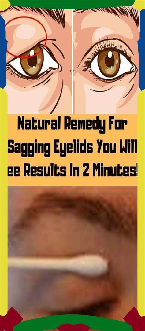 Natural Remedy For Sagging Eyelids You Will See Results In 2 Minutes