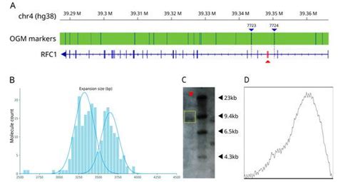 Natalia Dominik On Linkedin Optical Genome Mapping Enables Detection And Accurate Sizing Of Rfc1…