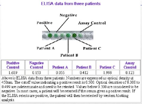 Lab Elisa Qualitative Flashcards Quizlet