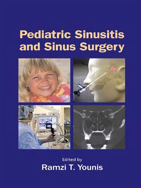 Pediatric Sinusitis And Sinus Surgery Pdf Skeletal System Human Head And Neck