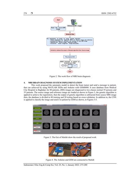 The Iot And Registration Of Mri Brain Diagnosis Based On Genetic