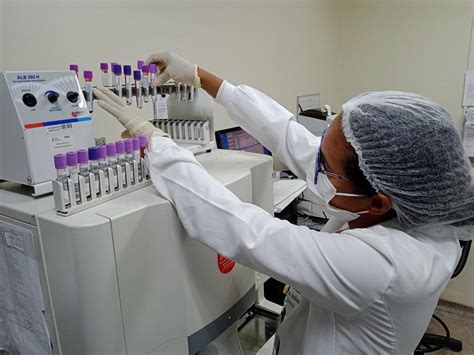 Unidade Realiza Exames Bioquímicos Hormonais Microbiológicos