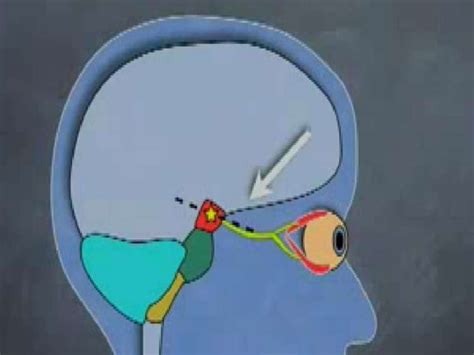 3rd Cranial Nerve Pptx