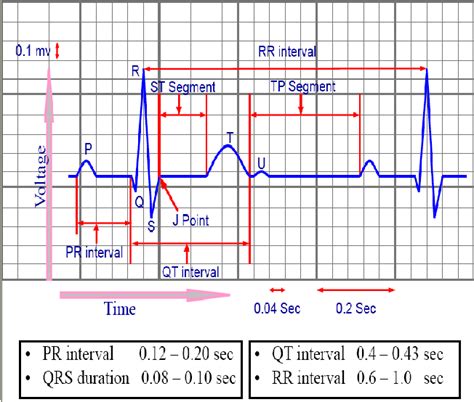 Figure 1 From Analysis Of Electrocardiograph Ecg Signal For The Detection Of Abnormalities