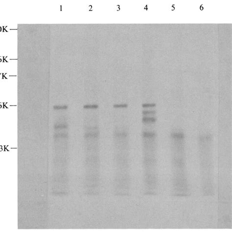 Immunoblot Analysis Of Proteins Precipitated With Different Mabs From