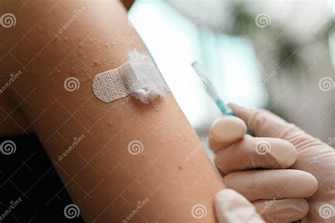 Girl With Plaster On The Shoulder From Injection Stock Image Image Of