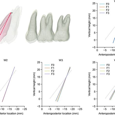 Displacement Patterns Of Posterior Teeth According To Archwire Download Scientific Diagram