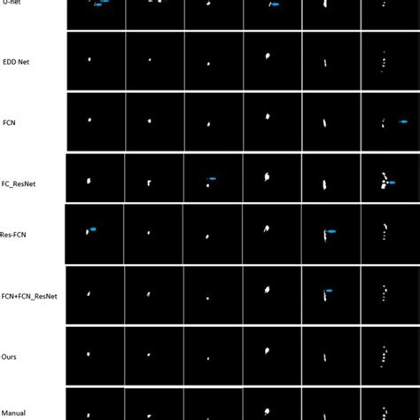 Six Image Cases Of Automated Vs Manually Segmented On Multi Modality