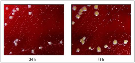 Glycopeptide Resistance In S Aureus Intechopen