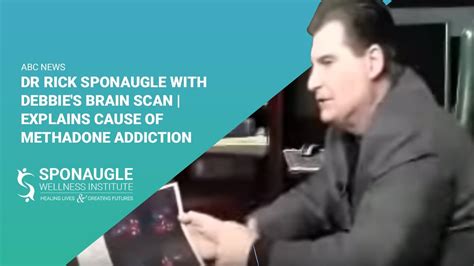 Dr Sponaugle Interviews National Media Coverage On Brain Science