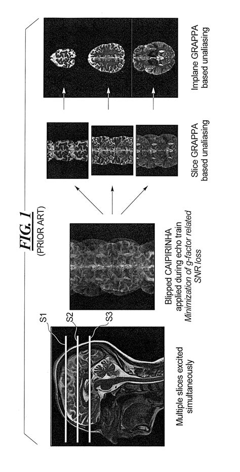 Magnetic Resonance Apparatus And Method For Simultaneous Multi Contrast Acquisition With