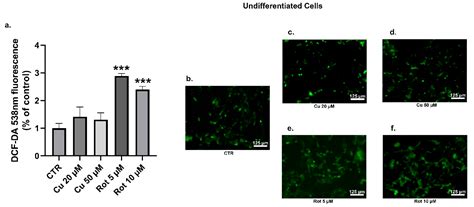 Copper Dependent Modulation Of α Synuclein Phosphorylation In