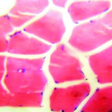 Corte Histológico Transversal De Musculo A Los Treinta Días De Aplicado