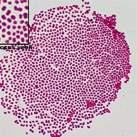 Paracoccus Denitrificans Vi Sinh đơn Dòng CÔng Ty CÔng NghỆ Sinh HỌc Nanomic