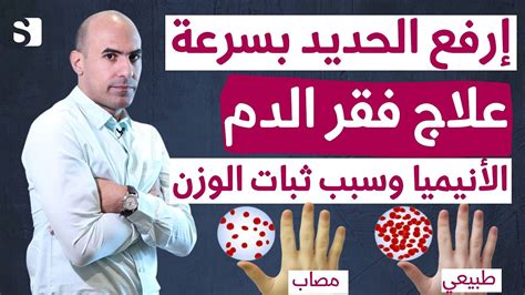 علاج نقص الحديد فقر الدم الانيميا بدون دواء اهم الاغذية لتقوية الدم