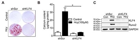 Inhibition Of Klf4 Attenuates Hcy Induced Vsmc Calcification Vsmc Were Download Scientific
