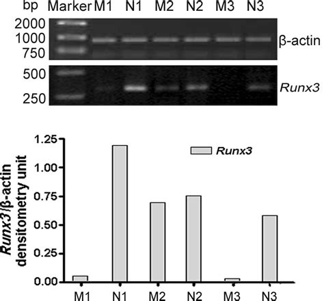 Runx3 Expression In Lymph Nodes With Metastasis Is Associated With The