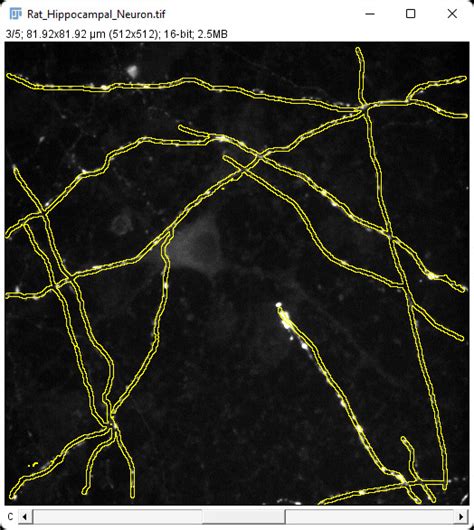Neuron Segmentation Image Analysis Imagesc Forum
